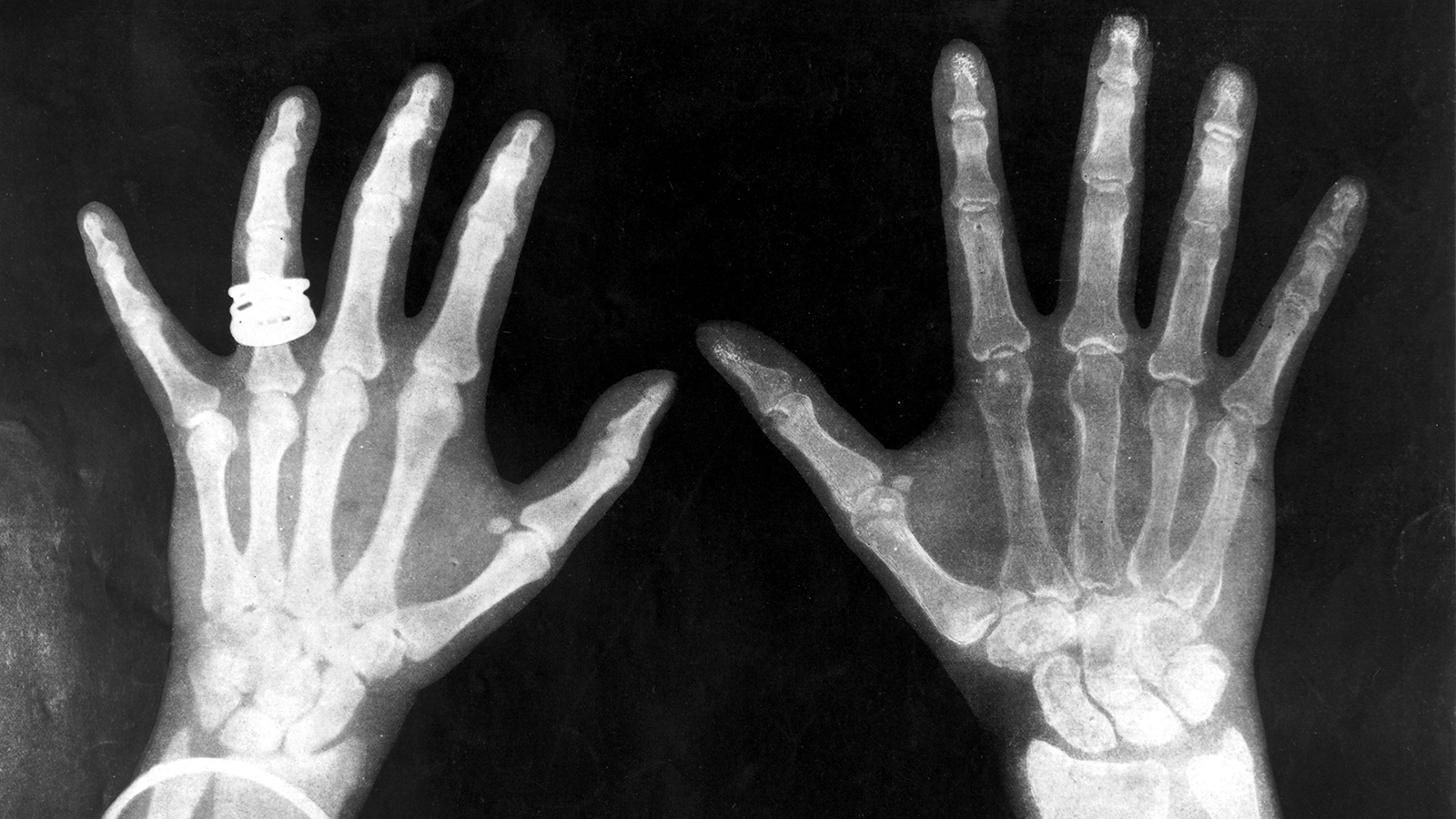 X-Ray Destruction – Document Destruction Services